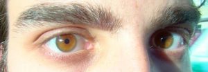 Rh Negative Trait or Not: Amber Eyes – The Rh Negative Blog